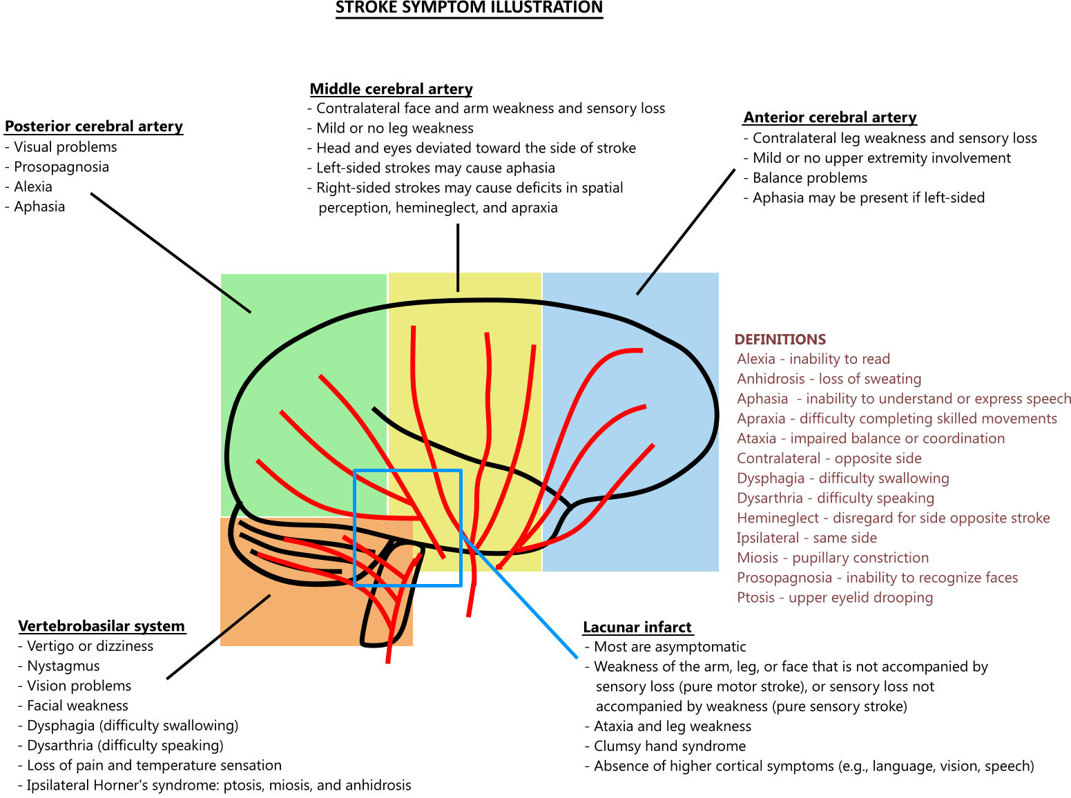 Stroke Symptom Illustration